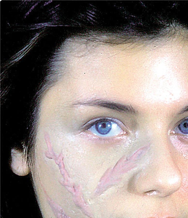 Woochie Scar Set 3 Prosthetics Makeup Kit - Costumes.com.au